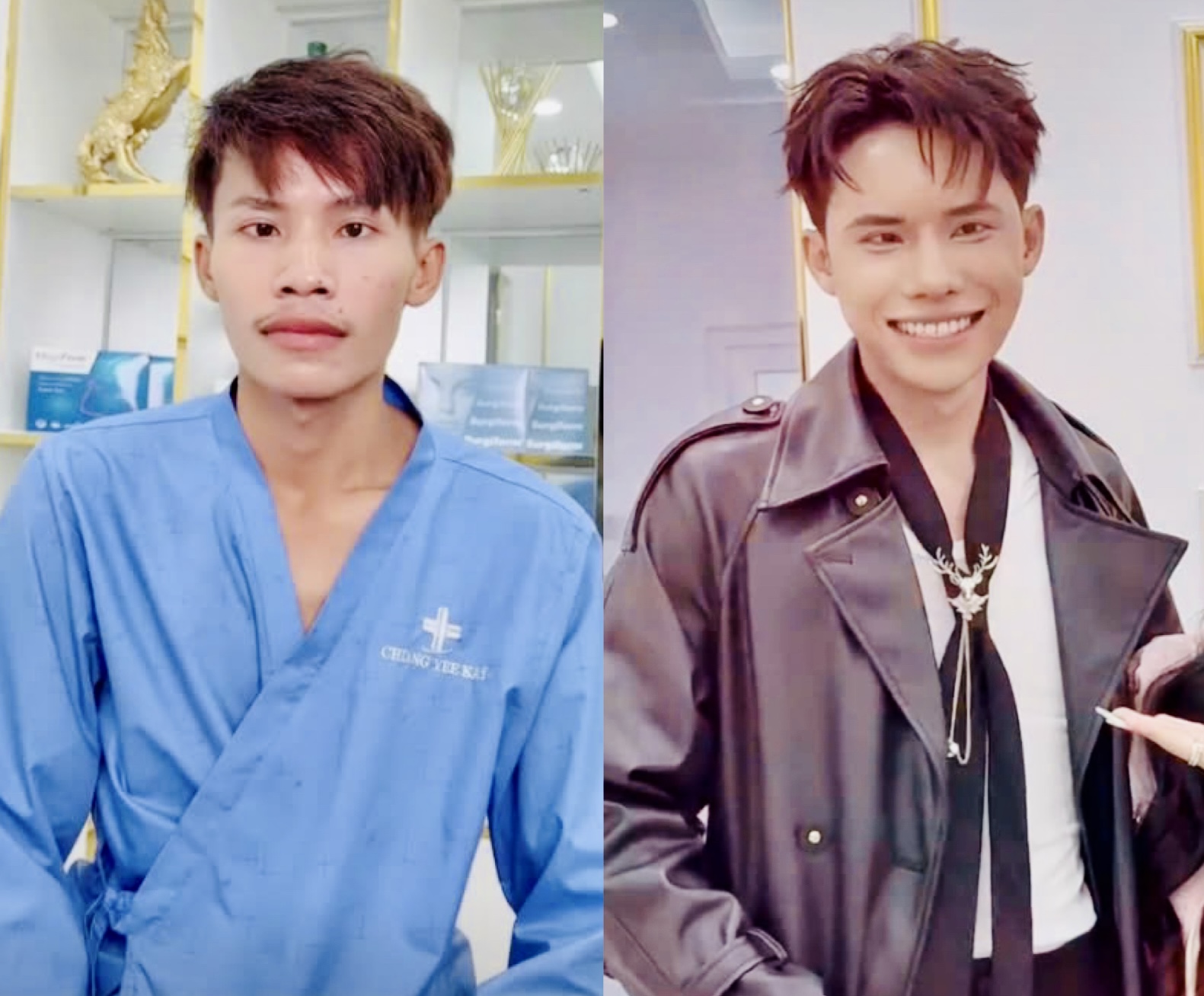 Lai Thai khoe diện mạo mới sau thẩm mỹ - Tuổi Trẻ Online