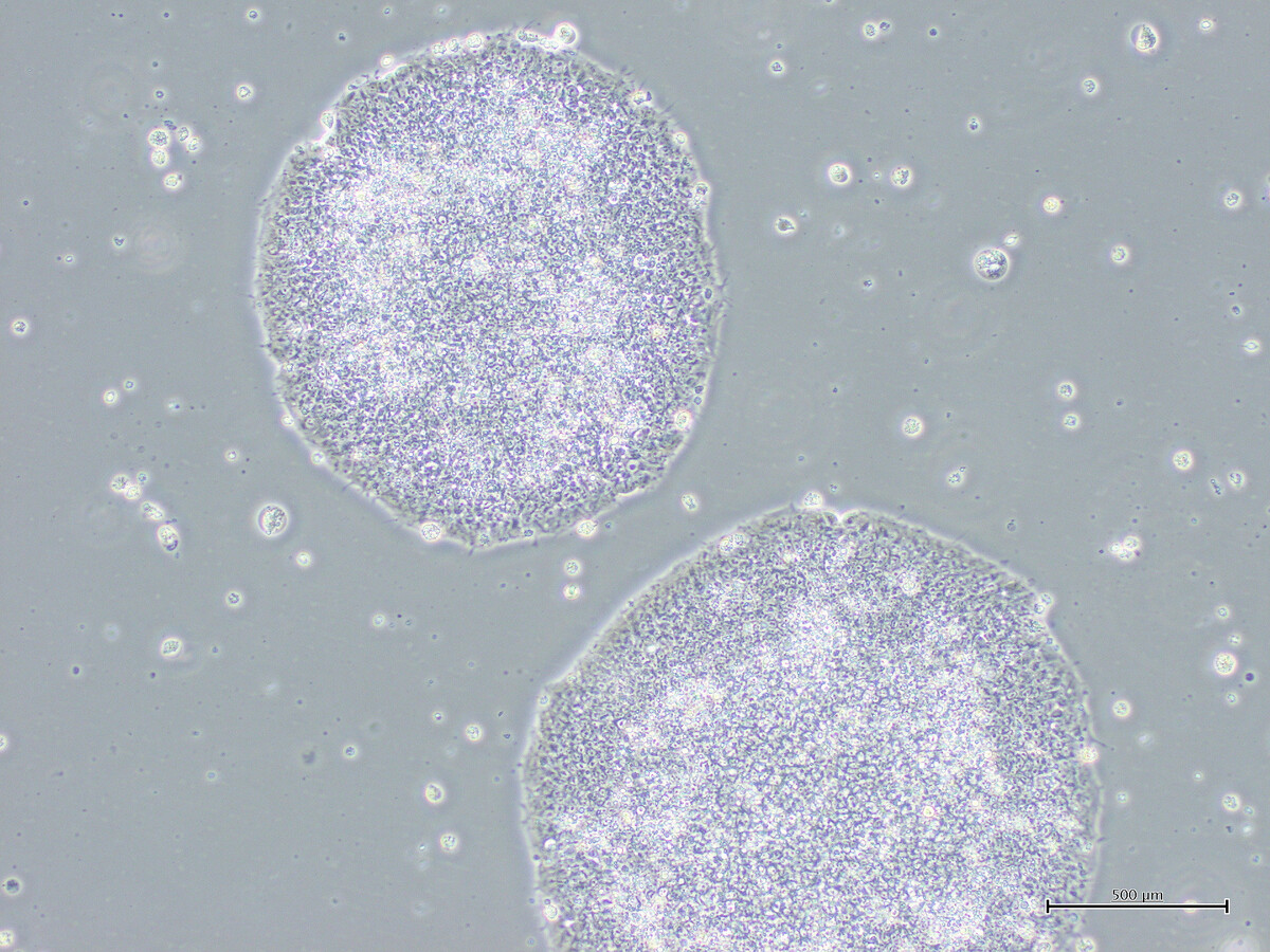 Japan oks world's 1st iPS cell treatments