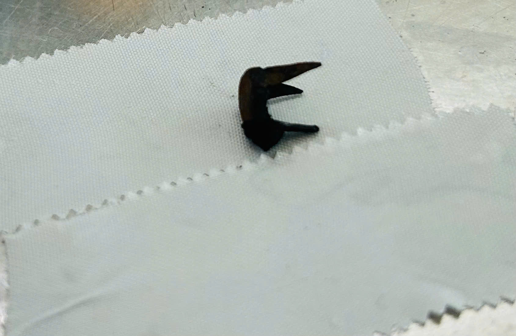 Un objeto extraño y oxidado alojado en el pulmón de un niño le provocó ...