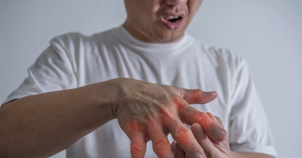 Bệnh gout dễ tái phát, lưu ý những dấu hiệu phải khám sớm - Tuổi Trẻ Online