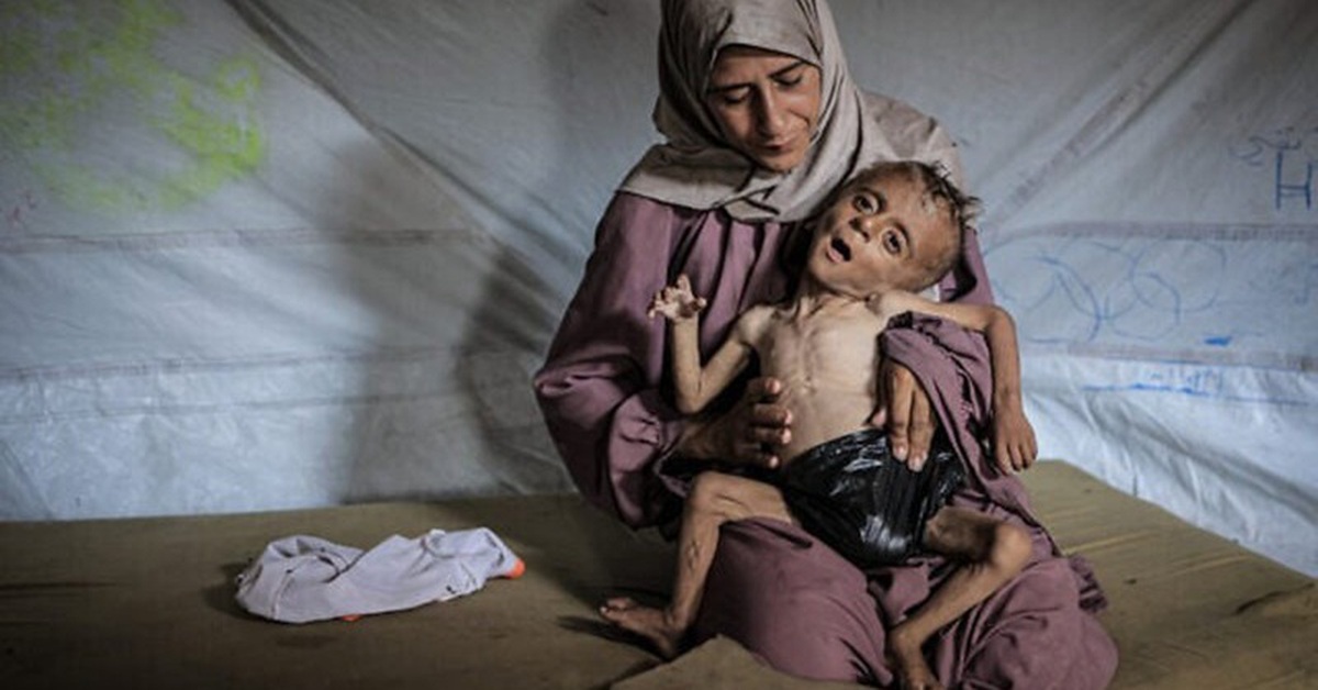 Bức ảnh cậu bé gầy trơ xương vì đói ở Gaza bị tố là ảnh giả - Tuổi Trẻ ...