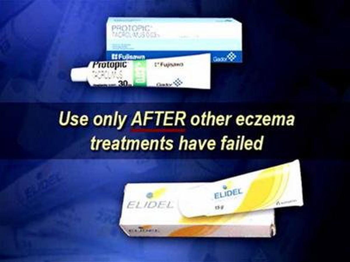 Cảnh báo nguy cơ ung thư khi dùng Elidel và Protopic - Tuổi Trẻ Online