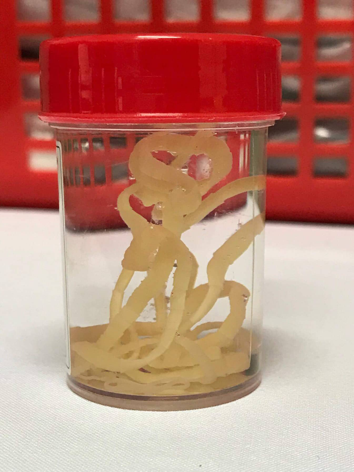 Doctors remove meter-long tapeworm from Vietnamese man’s intestines